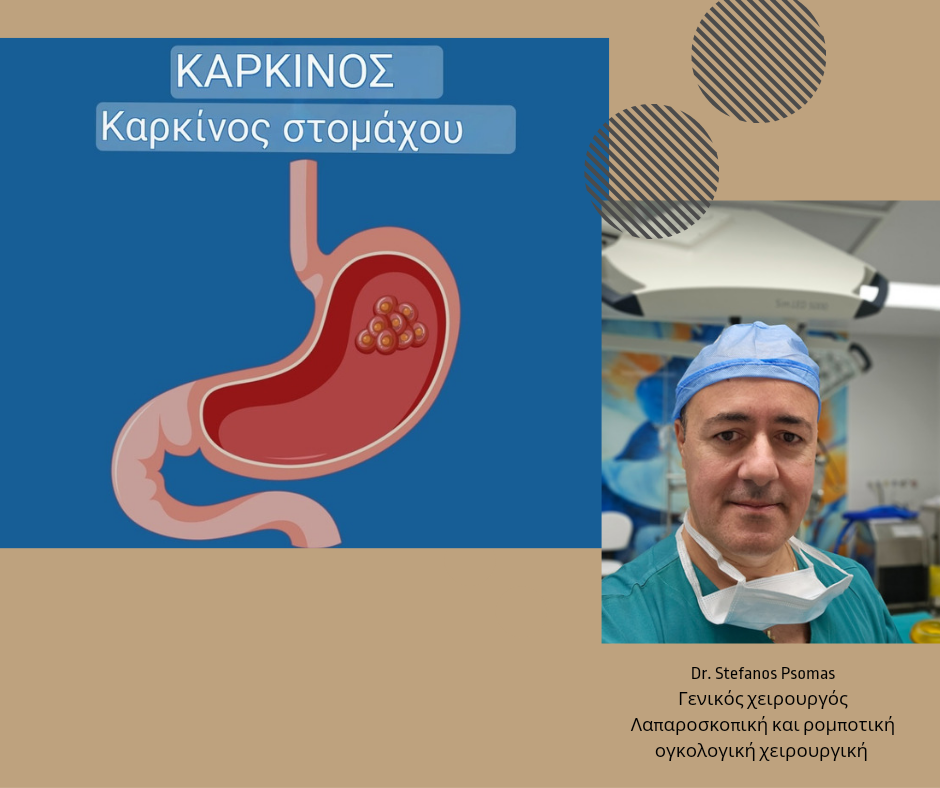 καρκίνος-του-στομάχου-αίτια-διάγνωση-αντιμετώπιση